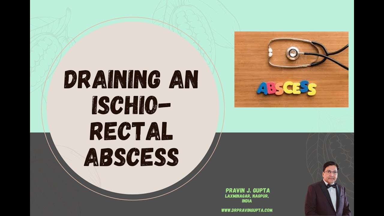 DRAINING AN ISCHIO-RECTAL ABSCESS - YouTube