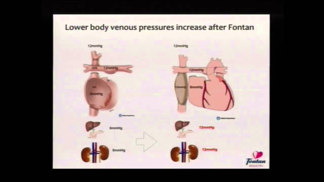 Professor David Winlaw - YouTube