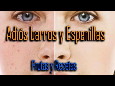 Adiós espinillas y Barritos - YouTube