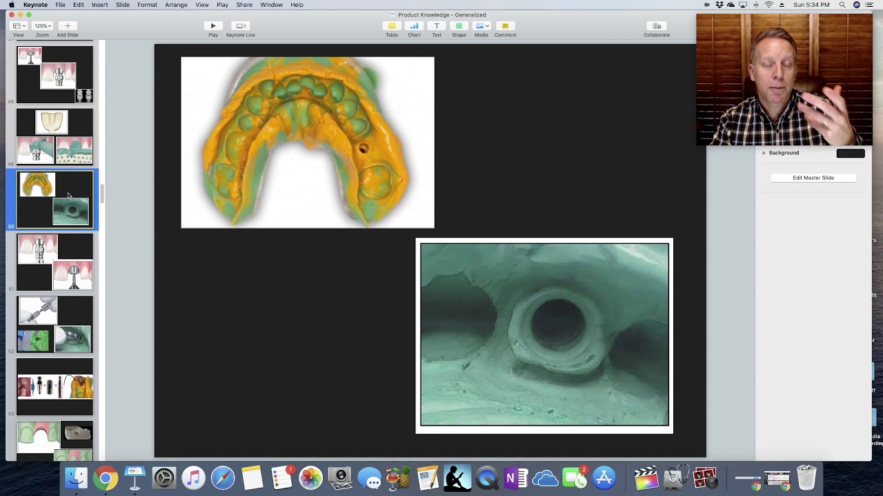Implant Impression and Lab Process. Education for dental staff. - YouTube