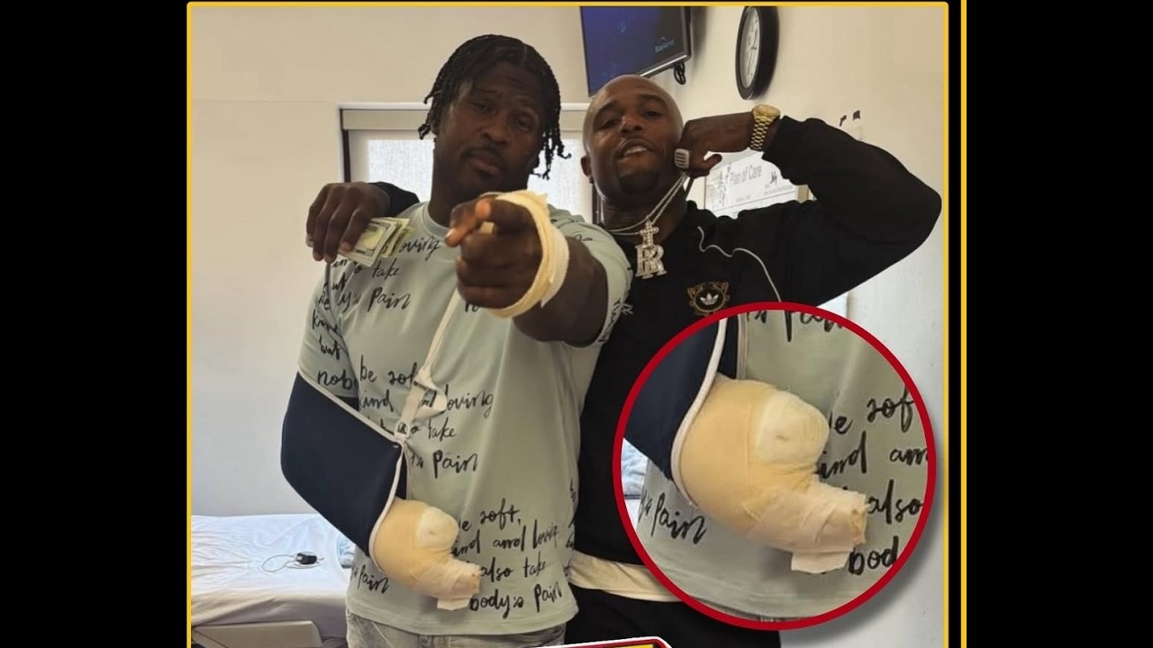 4XTRA SHOWS OFF HAND AFTER VIRAL 4TH OF EXPLOSION - YouTube