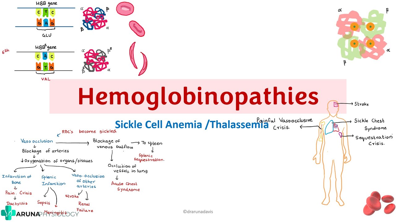 HEMOGLOBINOPATHIES| SICKLE CELL ANEMIA |THALASSEMIA | Physiology |MBBS ...