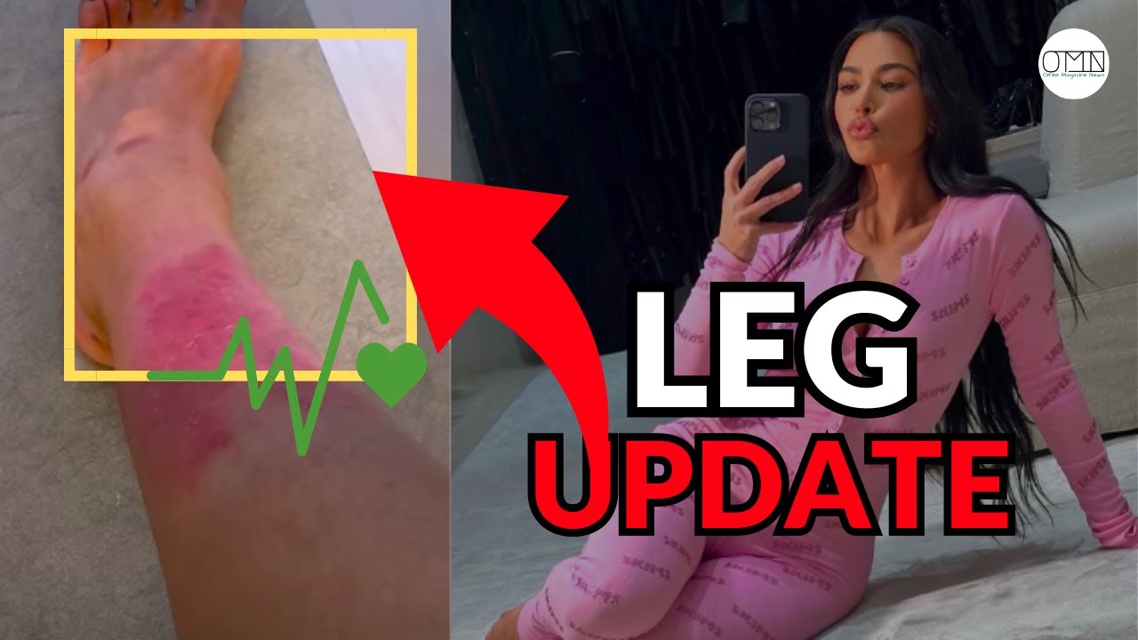 Kim Kardashian's PAINFUL Psoriasis Shock – LEG UPDATE! 😳👀 #celebnews ...