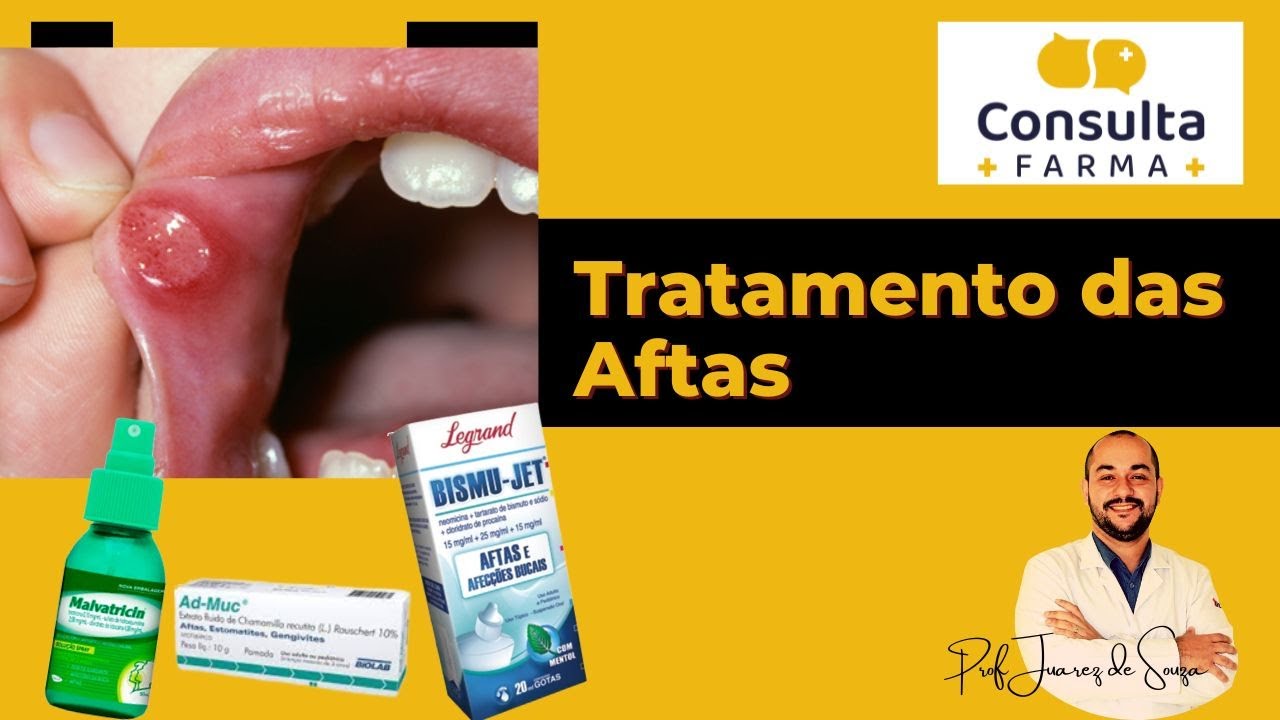 03 Medicamentos para Aftas e Lesões Orais - YouTube