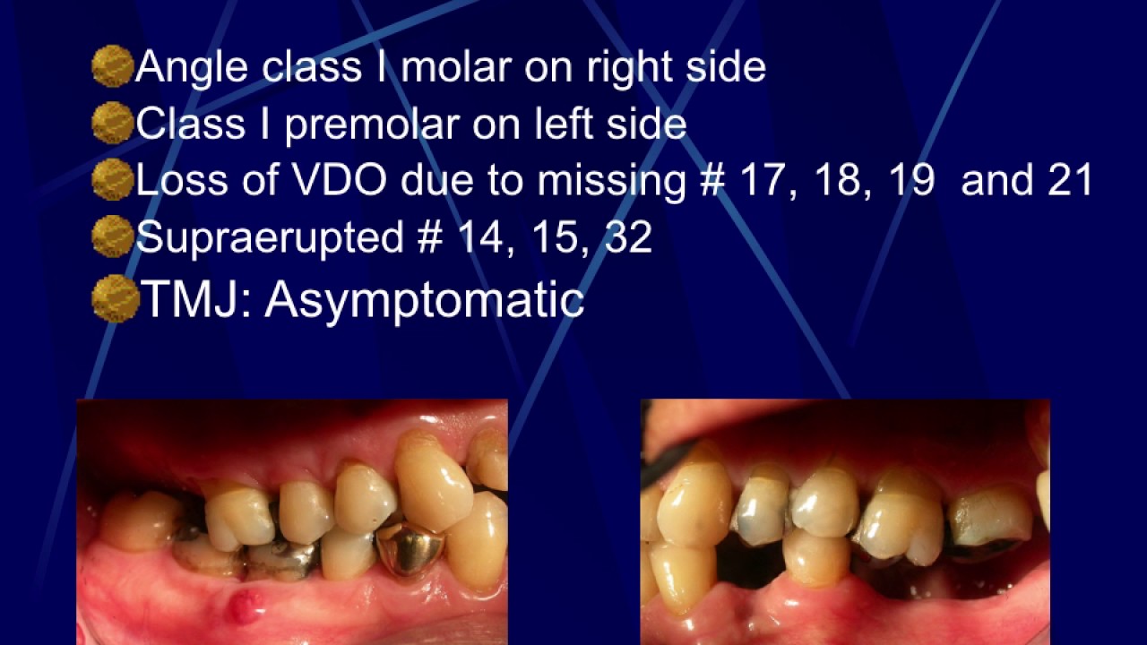 Comprehensive Care Treatment Plan Presentation | Dr. Alfred Khallouf ...