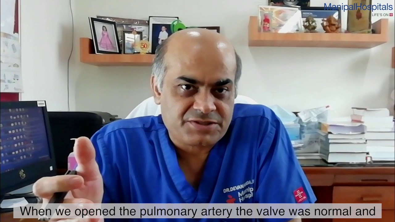 Dr. Devananda NS | Complex Heart Surgery on a Baby | Manipal Hospitals ...