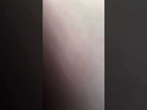 Coughing (violent fit with vomiting)