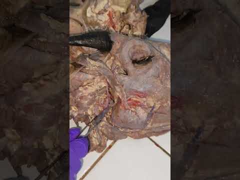 regio capitis medial & lateral - YouTube