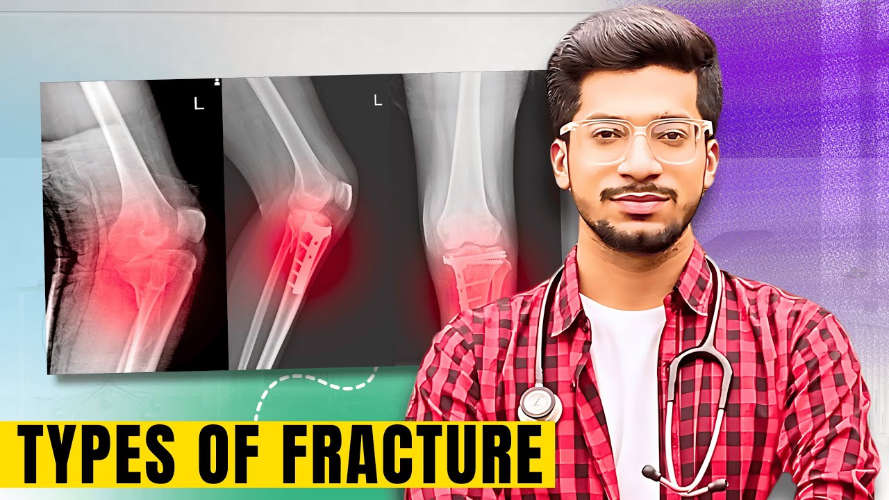 Types of Fracture | Block 2 Osve - YouTube