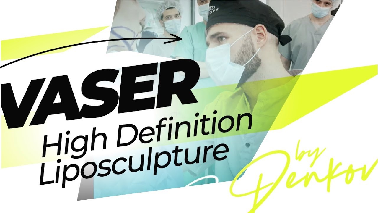 VASER HD LIPO: Д-Р ДЕНКОВ ОТГОВАРЯ НА ВАШИТЕ ВЪПРОСИ. - YouTube