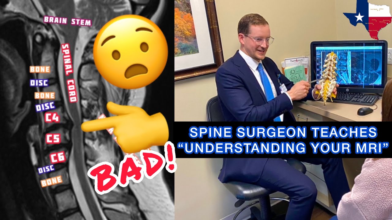 How to Read Your Spine MRI (Pinched Nerves, Cord Compression) - YouTube