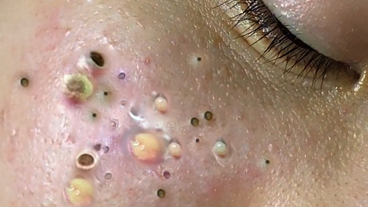 𝐂𝐡𝐢𝐥𝐥 𝐘𝐨𝐮𝐫 𝐋𝐢𝐟𝐞 𝐖𝐢𝐭𝐡 𝐋𝐍𝐆 𝐒𝐤𝐢𝐧 𝐂𝐚𝐫𝐞 #7901 - YouTube