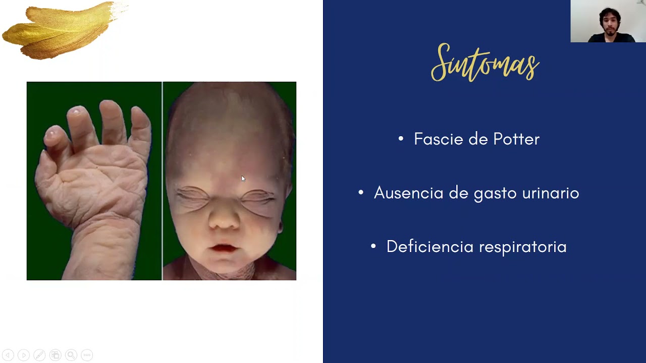 Secuencia de Potter - YouTube