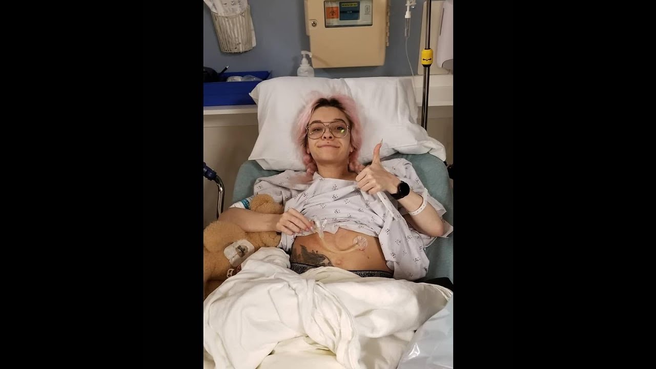 Feeding Tube Surgery YouTube