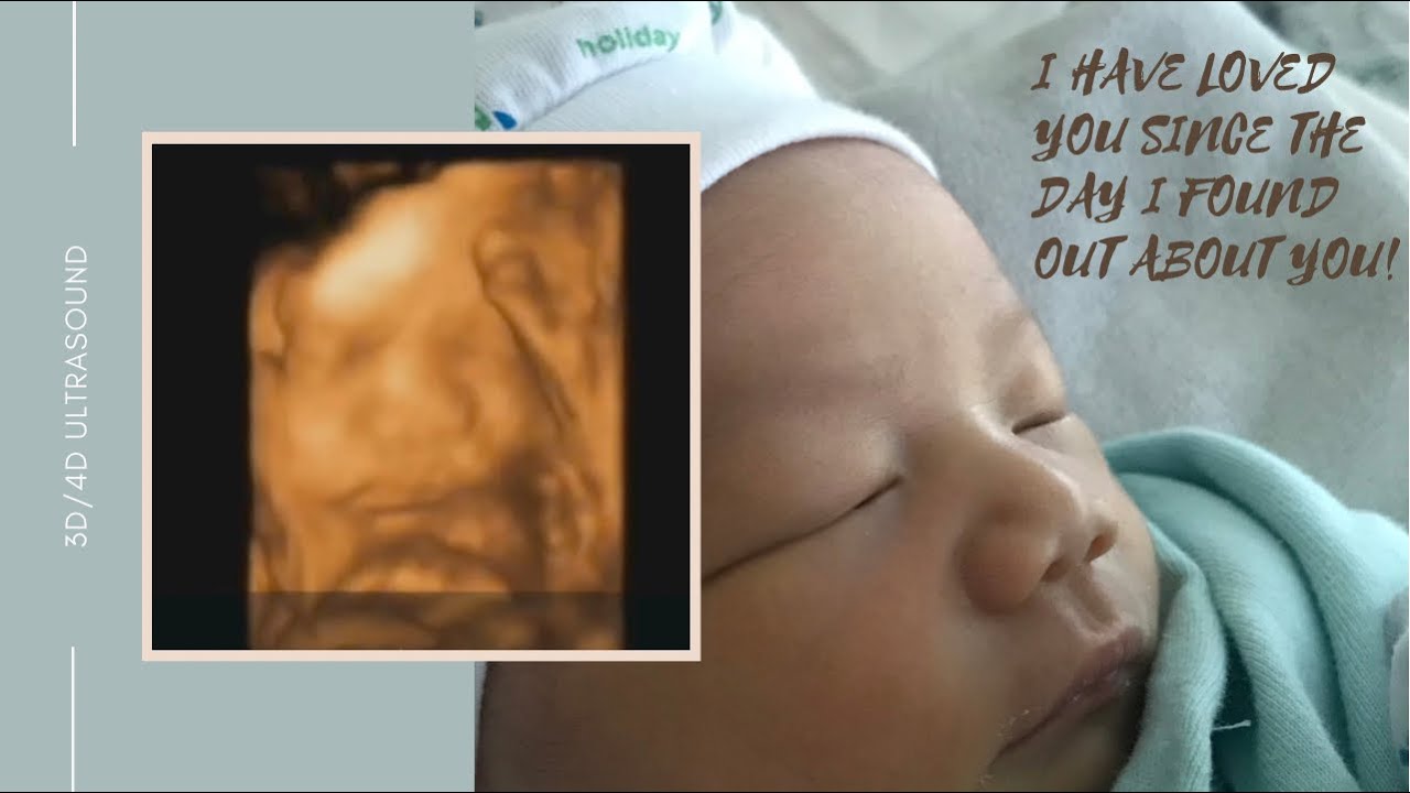 3D/4D Ultrasound at 33 Weeks (Part 1) | February 2019 | Cebu City | The ...