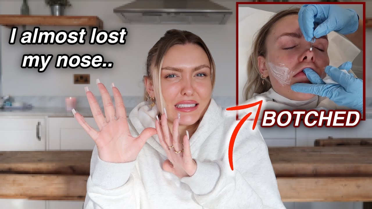How I almost Lost my Nose from Cosmetic Surgery.. (A Horror Story ...