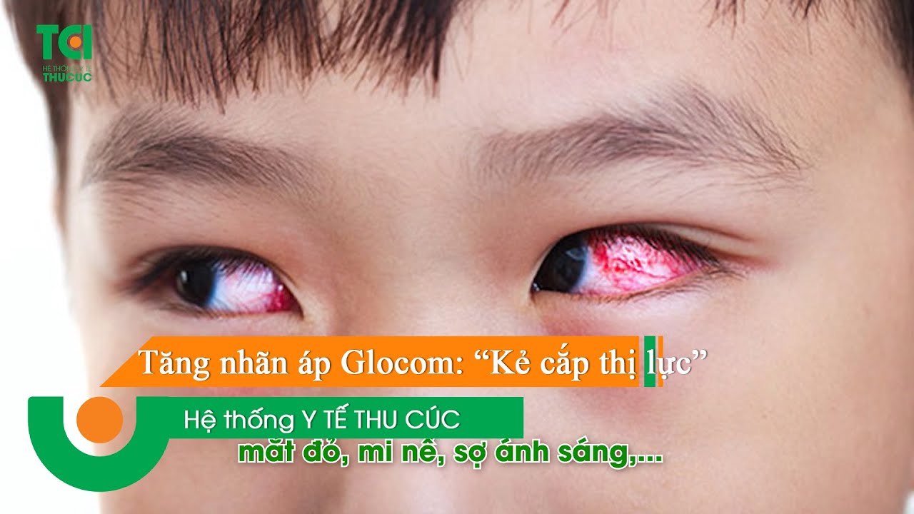 👁️‍🗨️ Tăng nhãn áp Glocom: “Kẻ cắp thị lực” nguy hiểm của đôi mắt - YouTube