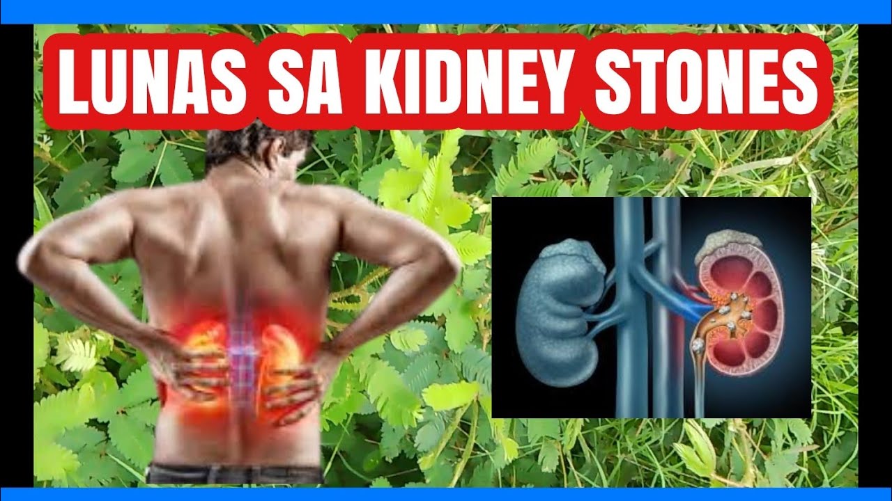 KIDNEY STONES at sakit sa ATAY AT 9 NA SAKIT KAYA YAN NG MAKAHIYA PLANT ...