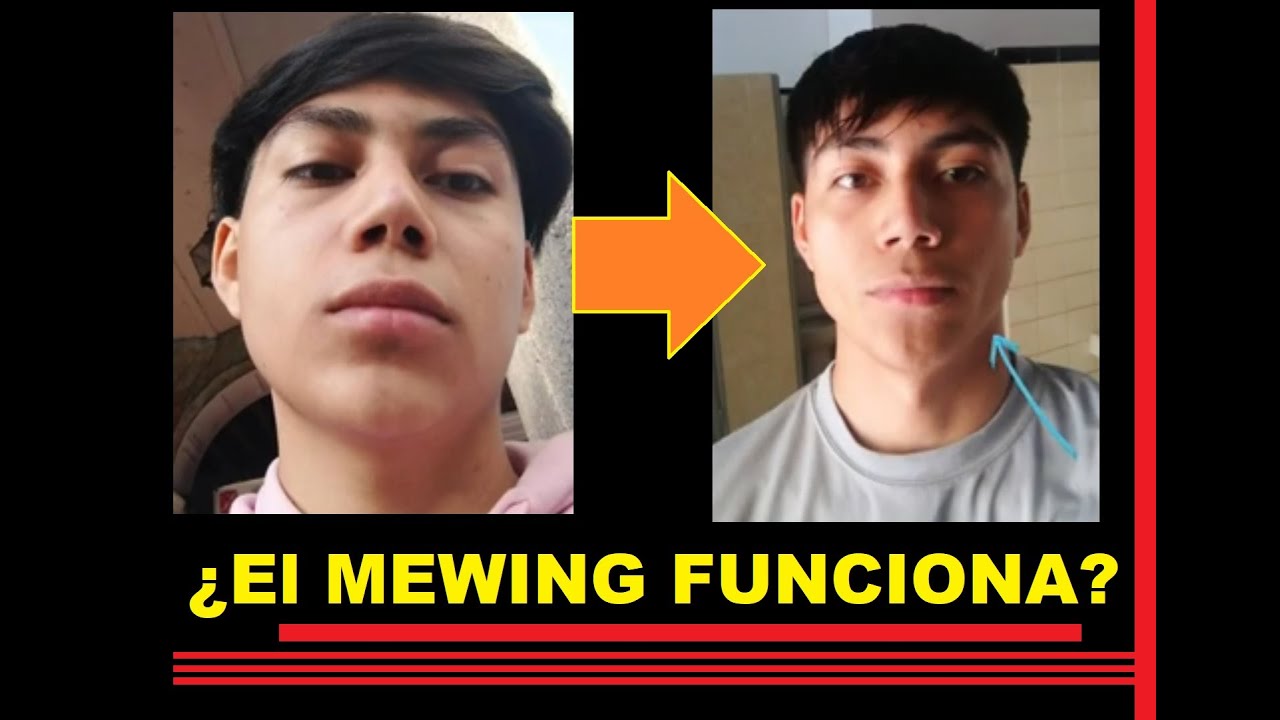 Como tener un Rostro Atractivo? | testimonios | MR. Mandibulas - YouTube