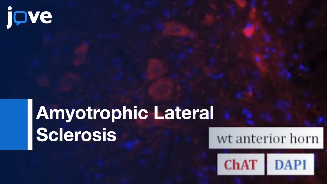 Amyotrophic Lateral Sclerosis (ALS) Spinal Cord Removal | Protocol ...