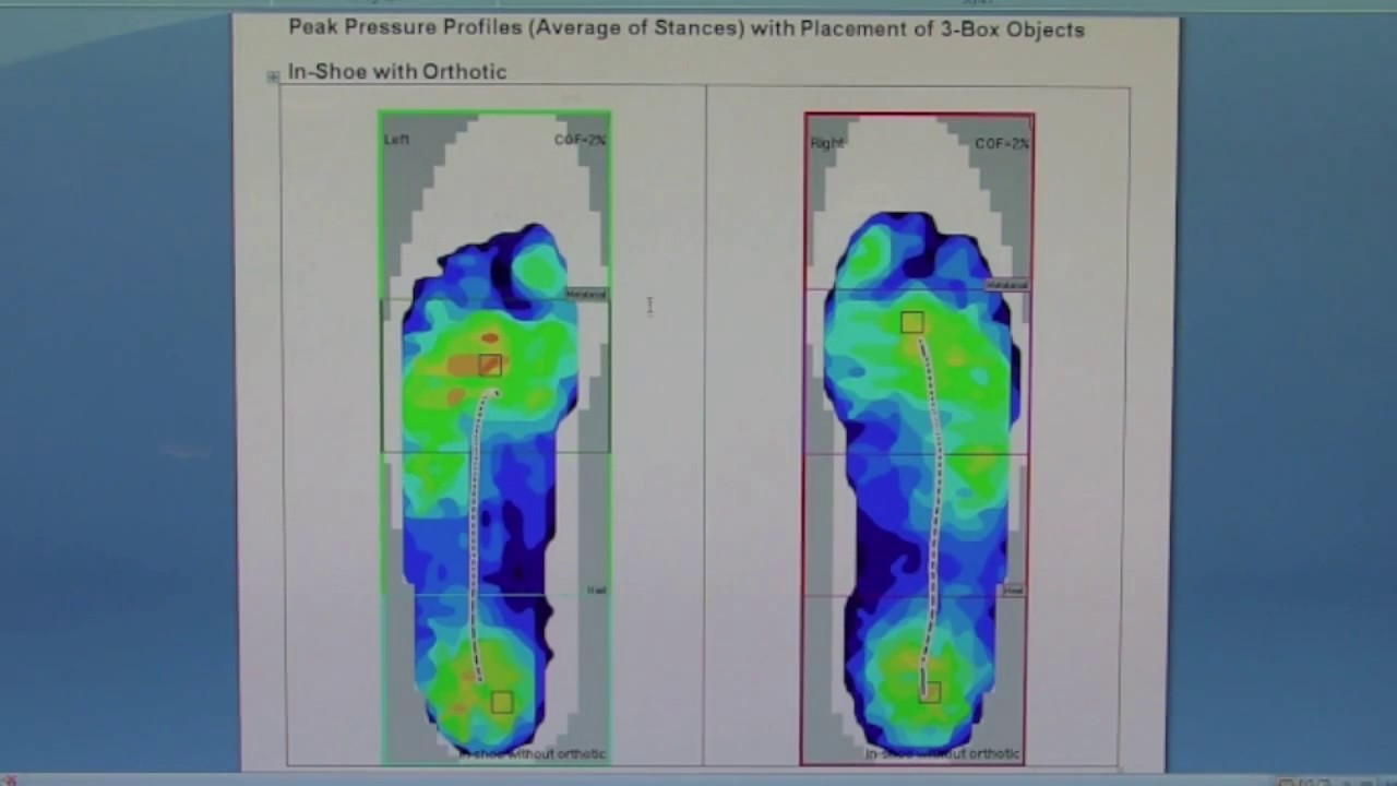 F-Scan Software Product Demonstration - YouTube