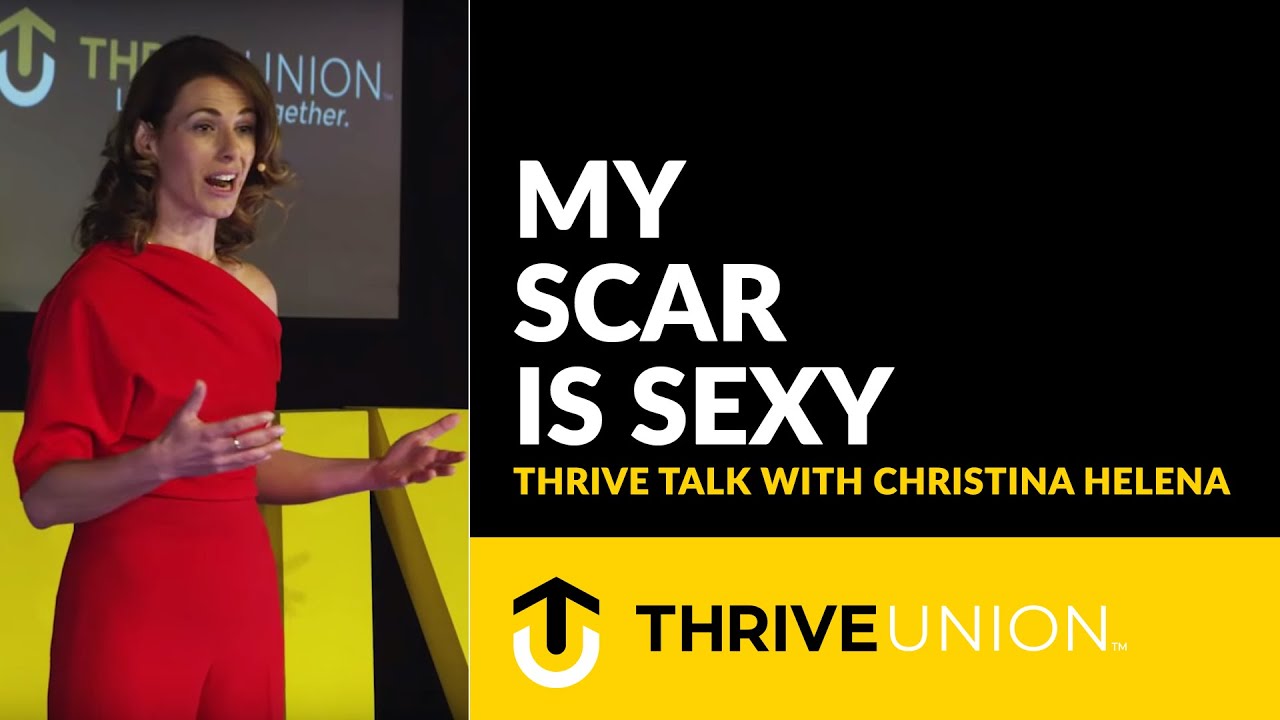 My Scar is Sexy: Thrive Talk featuring Christina Helena - YouTube
