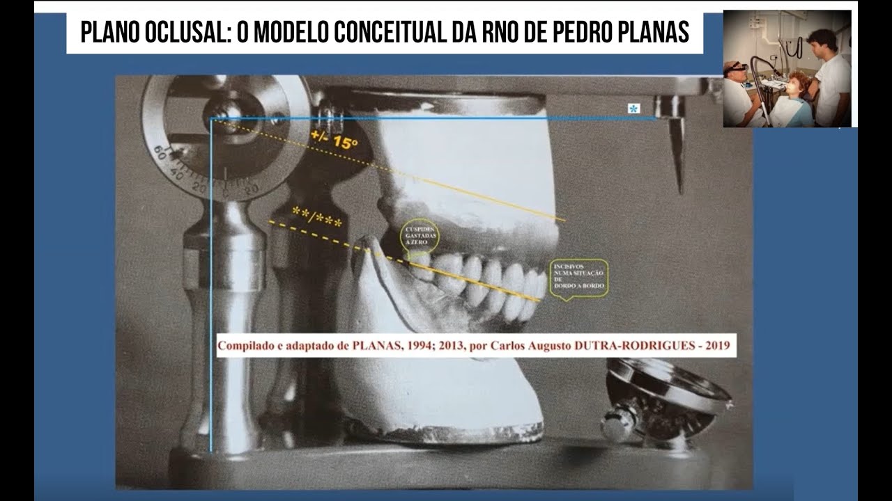 "Plano Oclusal" [CAMPO]: o modelo conceitual da RNO de Planas ...