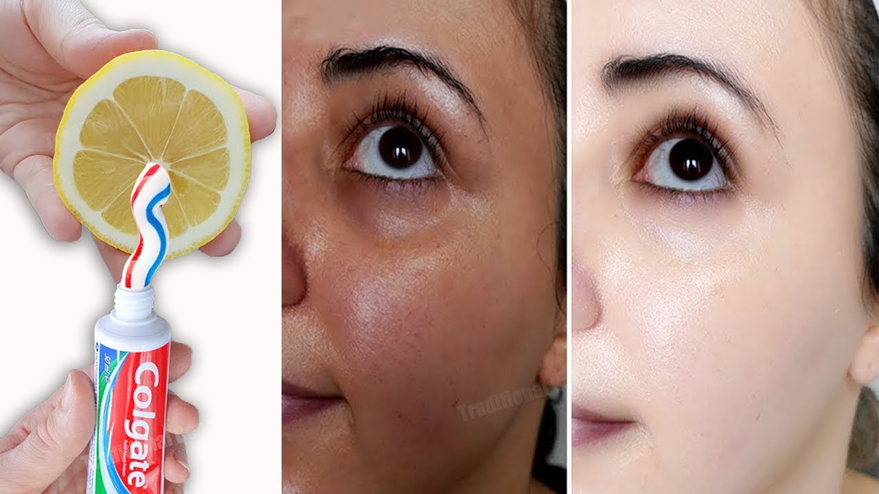 Apply Toothpaste on Your Skin and See Magical Result within 1 Hour ...
