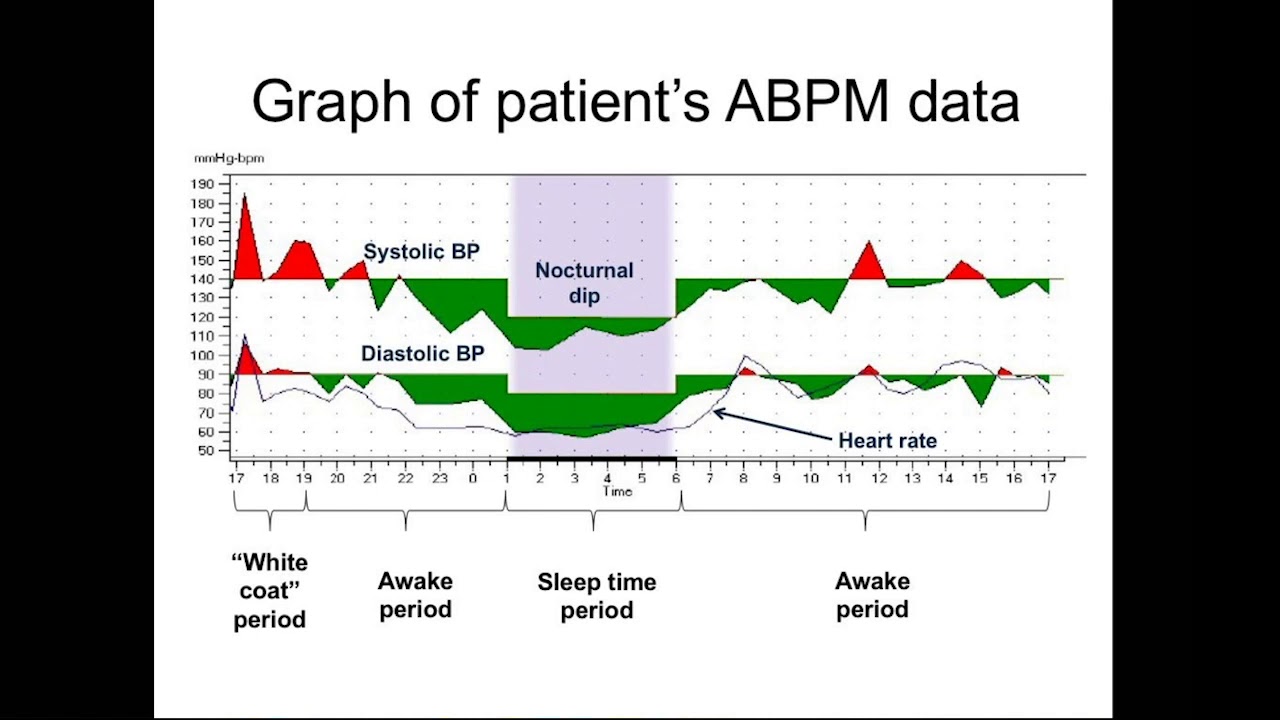 2018: Out-of-Office/Home Blood Pressure Monitoring - YouTube