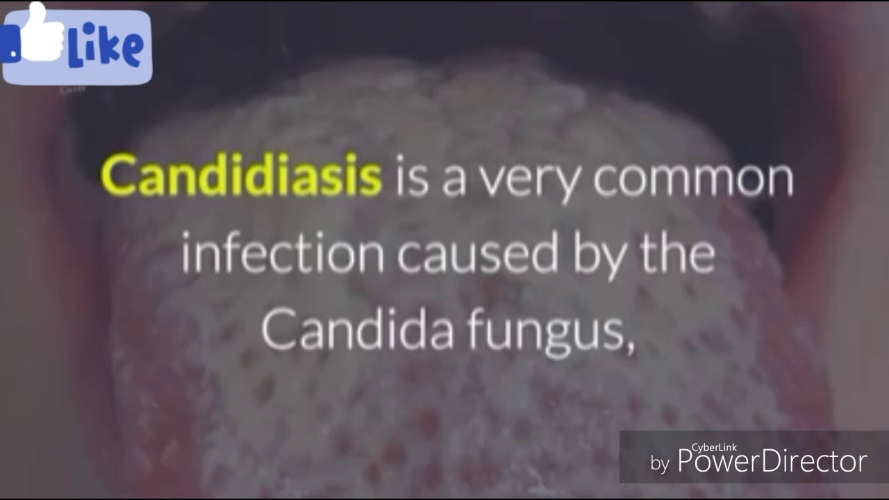 DIY CANDIDA SPIT TEST- EASY WAY TO CHECK FOR CANDIDA OVERGROWTH - YouTube