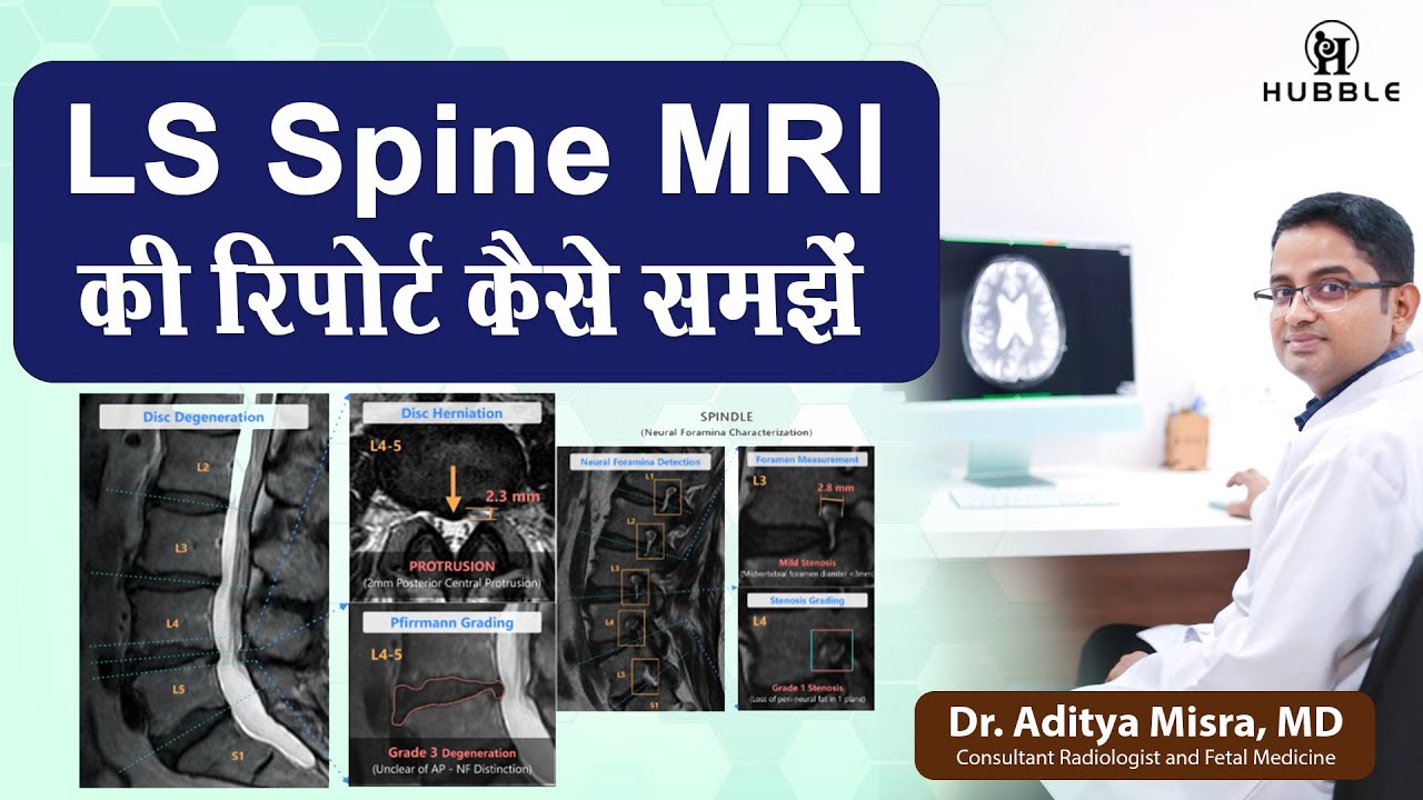 How to Read an LS Spine MRI (and understand your back pain !) - YouTube