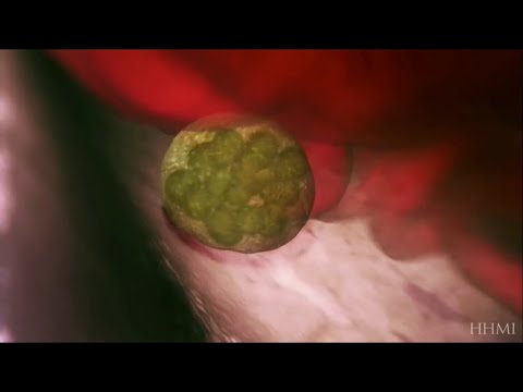 Asubha Meditation 15: Parasitic Consciousnesses - YouTube