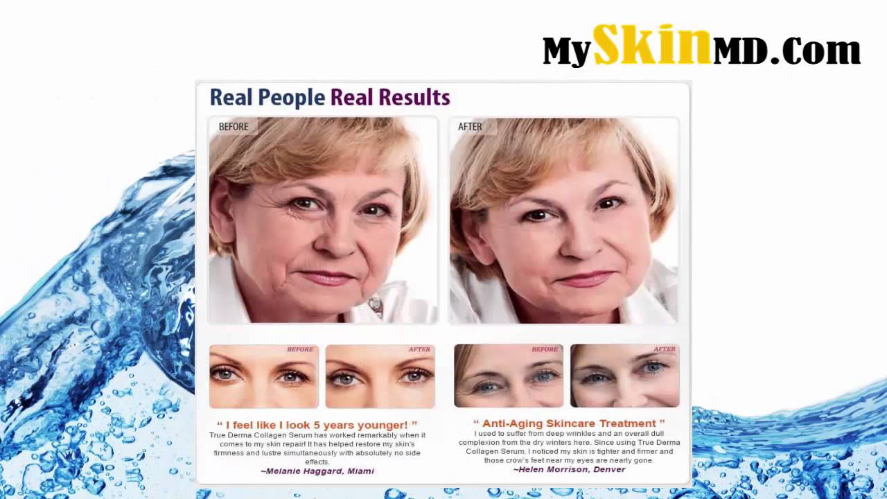 True Derma Collagen Serum Review - Address All Your Skin Care Needs ...