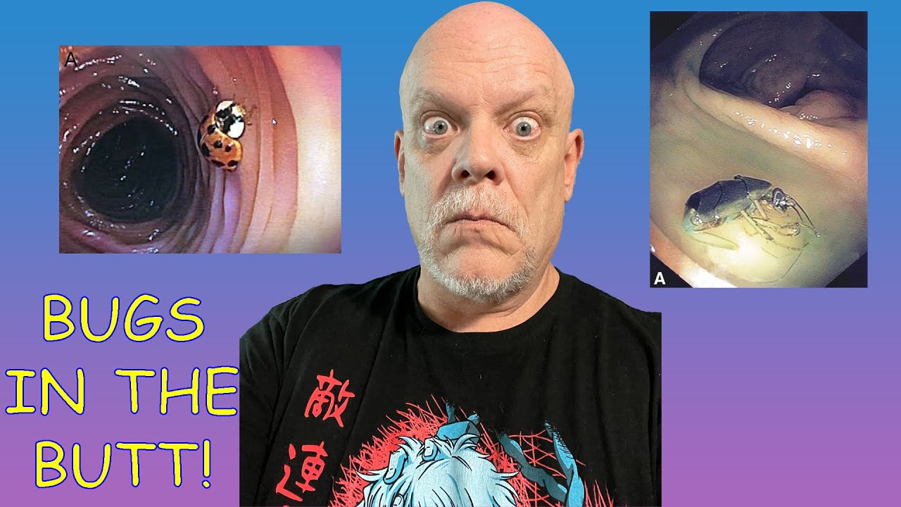 I May Have LITERAL Bugs Up My Butt!! 😧😧 - YouTube