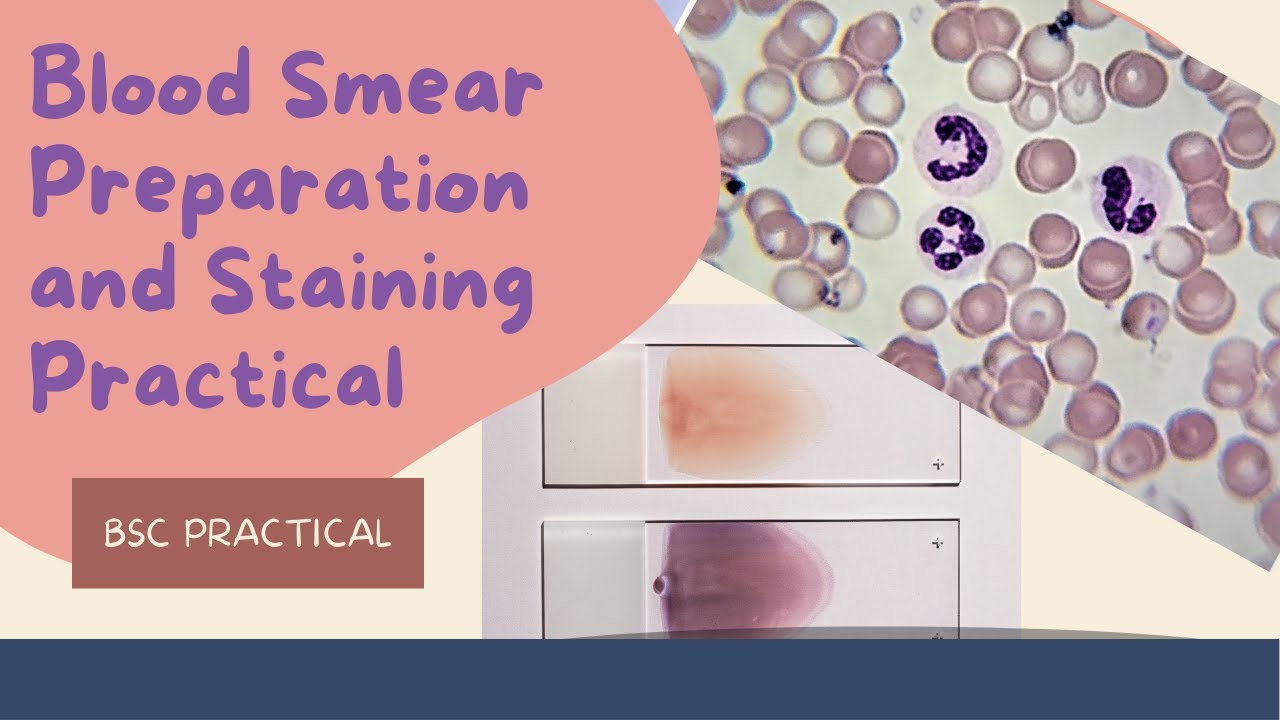 Blood Smear Preparation and Staining Practical | BSc Zoology Practical ...