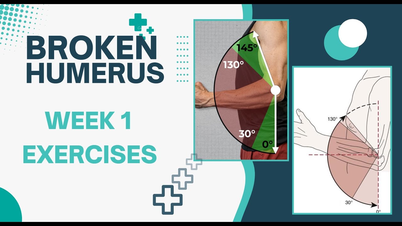 Humerus Fracture Recovery Exercises Week 1 - YouTube