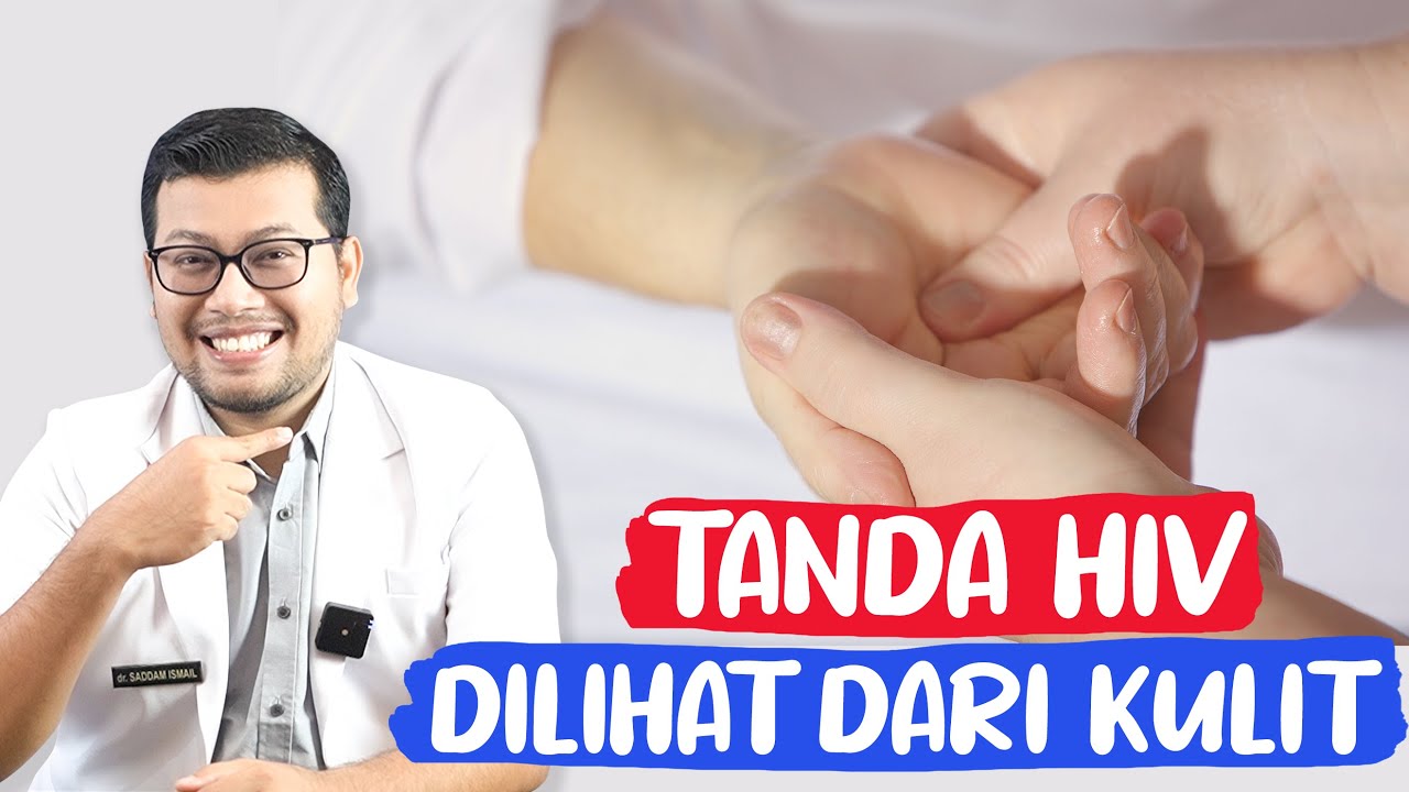 CIRI CIRI HIV YANG TERLIHAT DIKULIT - DOKTER SADDAM ISMAIL - YouTube