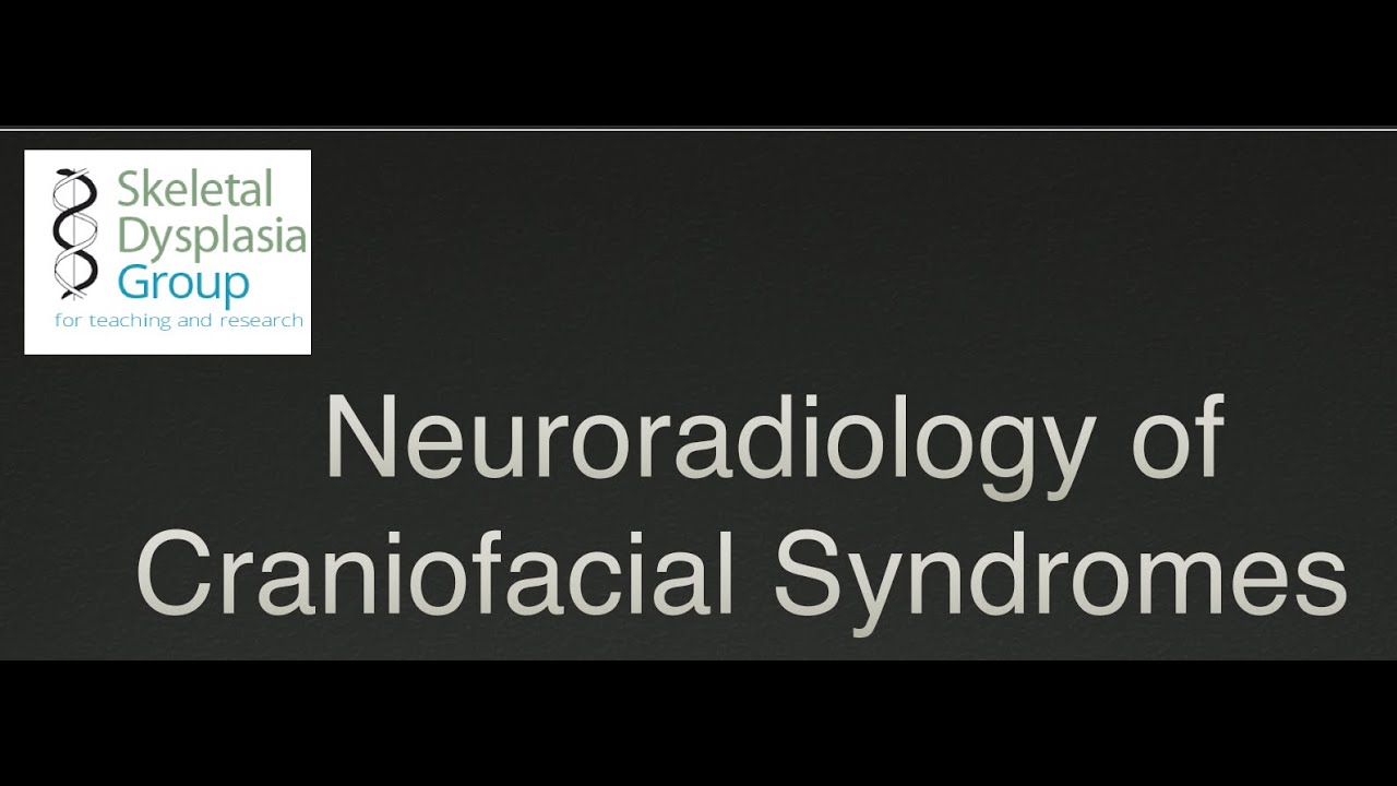 Neuroradiology of Craniofacial Syndromes: craniosynostosis and beyond ...