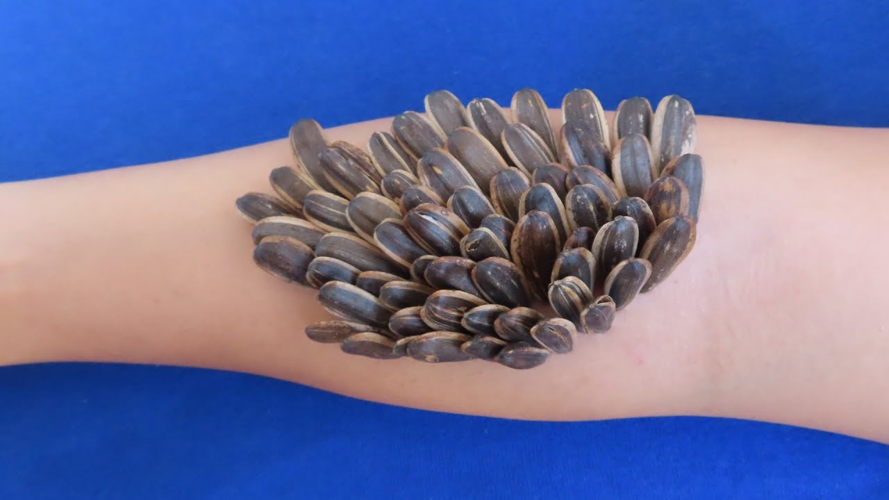 Wow, The best removing big ticks style on arm lady | Designed from ...