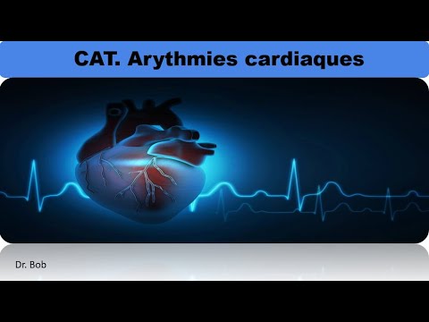 conduite à tenir devant les arythmies cardiaques (troubles de rythme ...