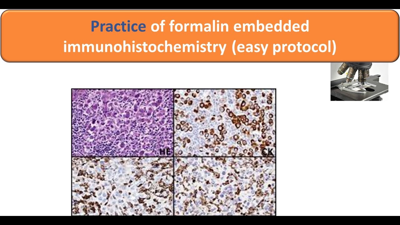 Practice of formalin embedded immunohistochemistry (easy protocol ...