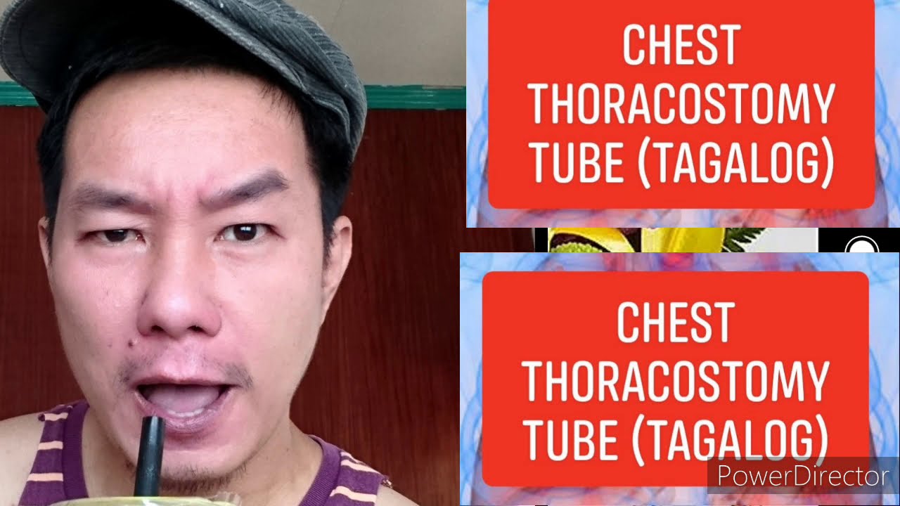 Chest Thoracostomy Tube - CTT (Tagalog) - YouTube