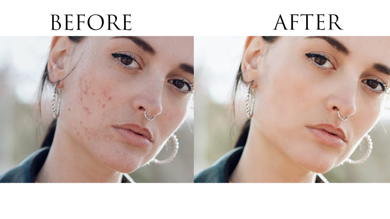 How To Remove Face Blemishes YouTube how-to-remove-face-blemishes-youtube