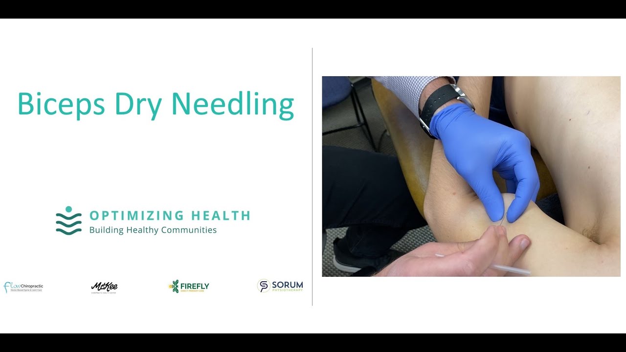 INSANE Biceps Twitch Response | Biceps Dry Needling - YouTube