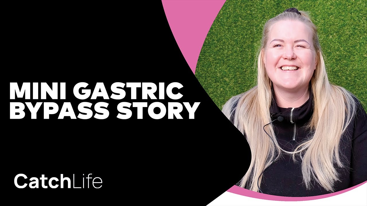 A Mini Gastric Bypass Story at CatchLife ! - YouTube