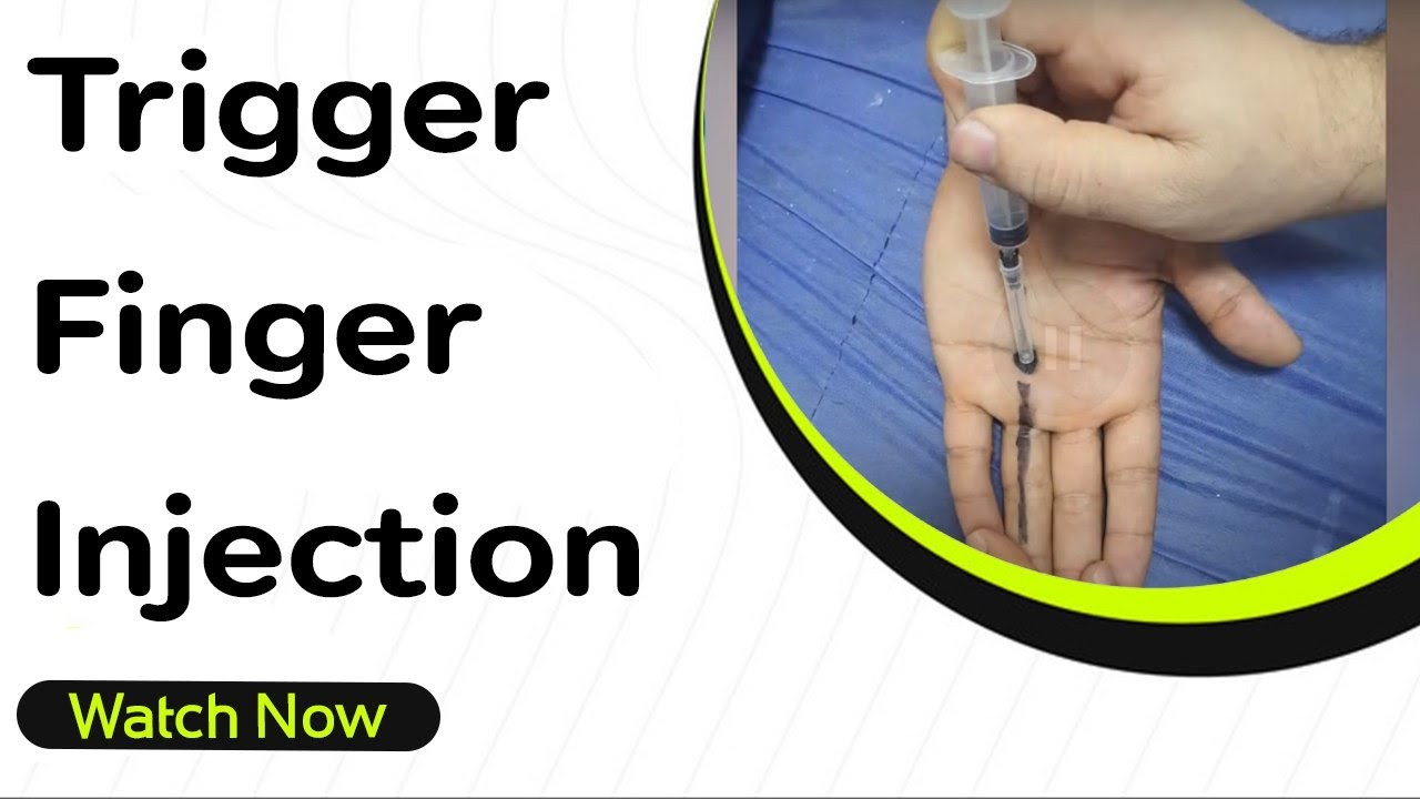 Trigger Finger Injection - YouTube