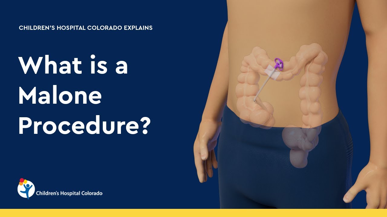 Pediatric Malone Procedure - YouTube