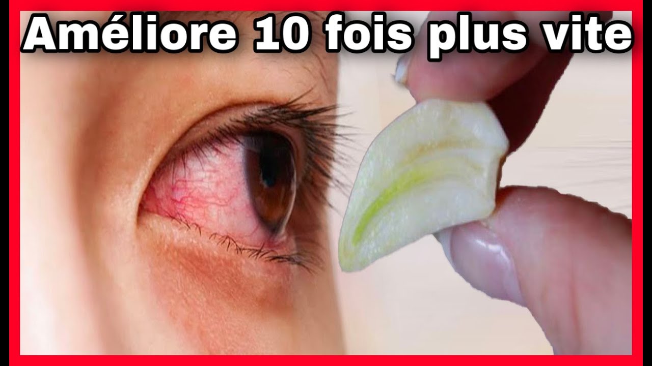 Ce remède naturel améliore plus de 90% de la vue : voici comment l ...