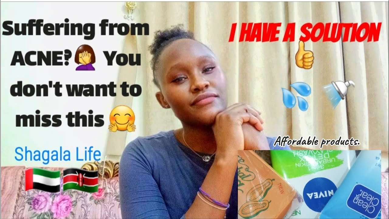 How to Deal With Stubborn Acne || Shagala || Kenyan 🇰🇪 - YouTube