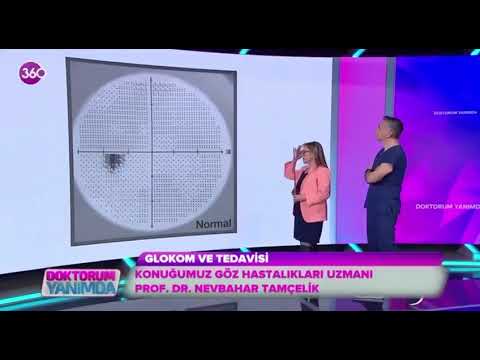 Glokomda görme alanı
